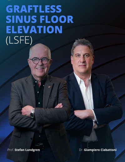 Graftless Lateral Sinus Floor Elevation (LSFE) - Online Dental Library Graftless Lateral Sinus Floor Elevation (LSFE) - Online Dental Library
