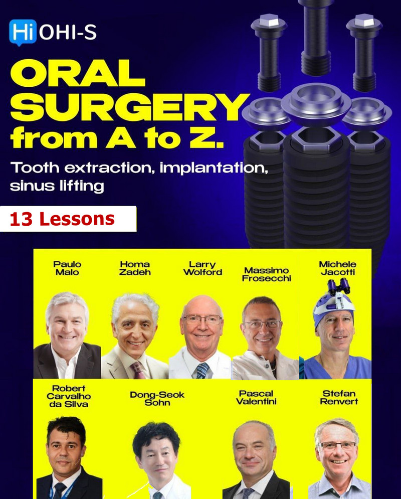 Oral Surgery from A to Z. Tooth Extraction, Implantation, Sinus Lifting ...